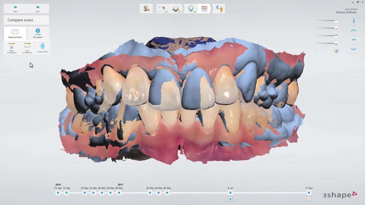 Intraoral scanner 3Shape TRIOS MOVE+ | Mediss Dental Clinic